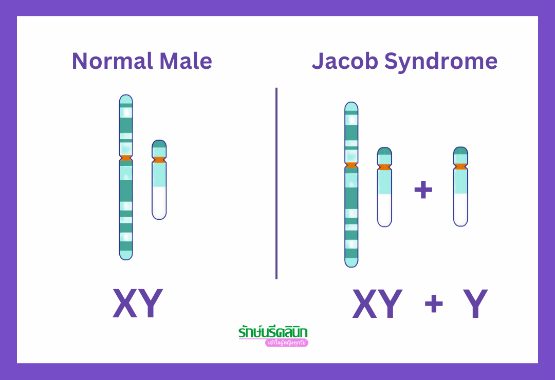 ความผิดปกติของโครโมโซมเพศ มีโรคอะไรบ้าง? อาการเป็นอย่างไร?